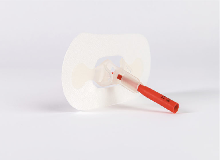 Suprapubic Catheter Stabilization Device | LECS I by Levity